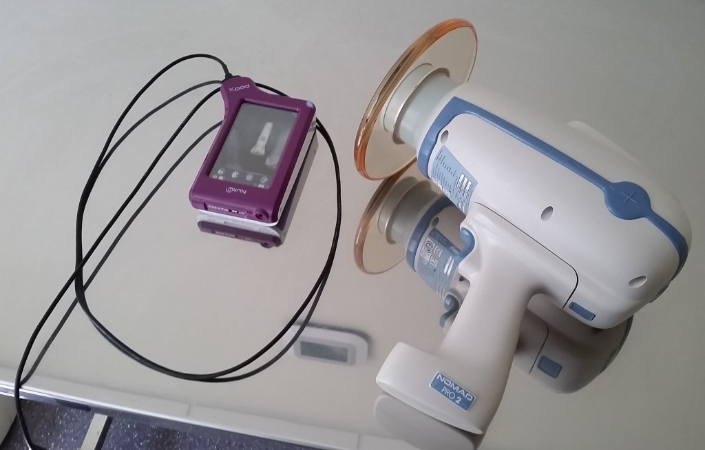 NOMAD PRO 2 Les nombreux avantages - 3D2i